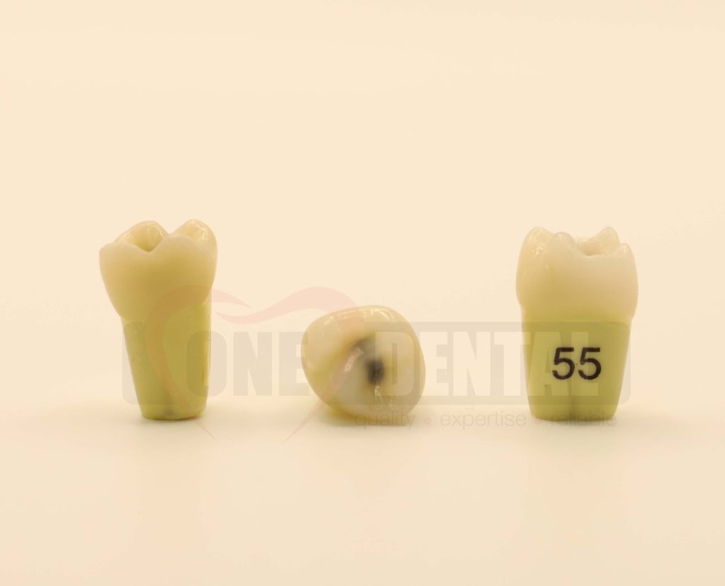 Caries Tooth 55 Occ for 1974 Paedo Model - One Dental