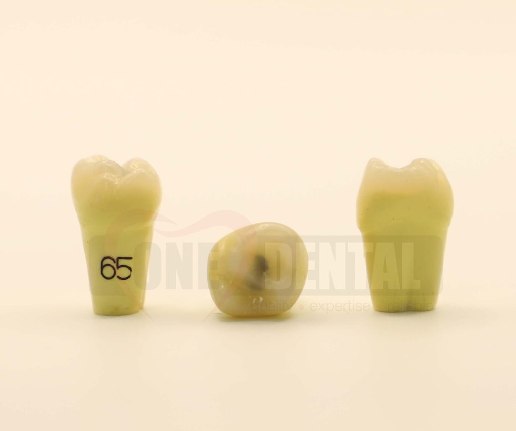 Caries Tooth 65 Occ for 1971 Paedo Model - One Dental