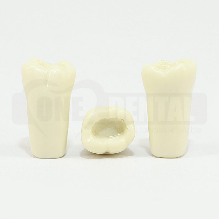Prep Tooth 36 OCC for 2008 Adult Model - One Dental